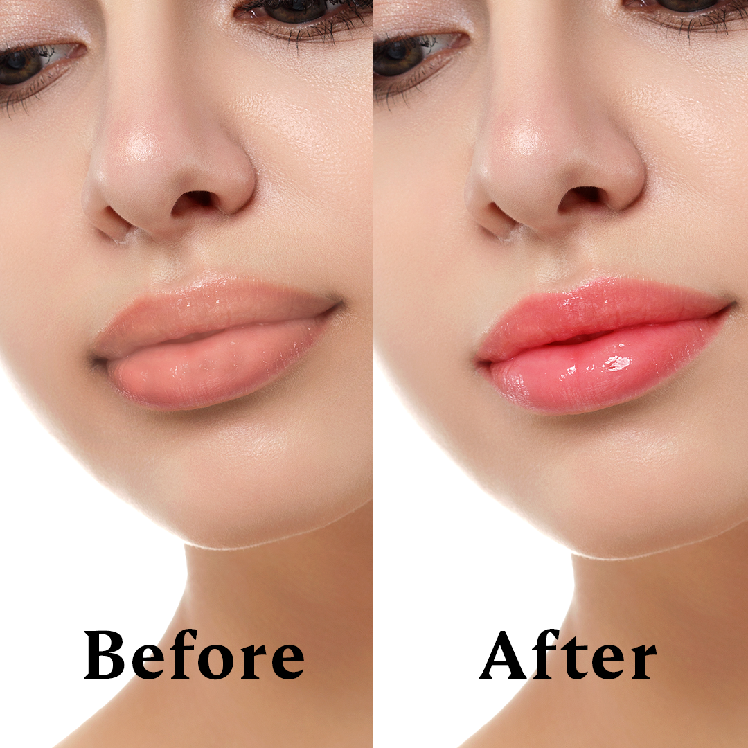 Smoochy Lip Gloss – Dazller Cosmetics